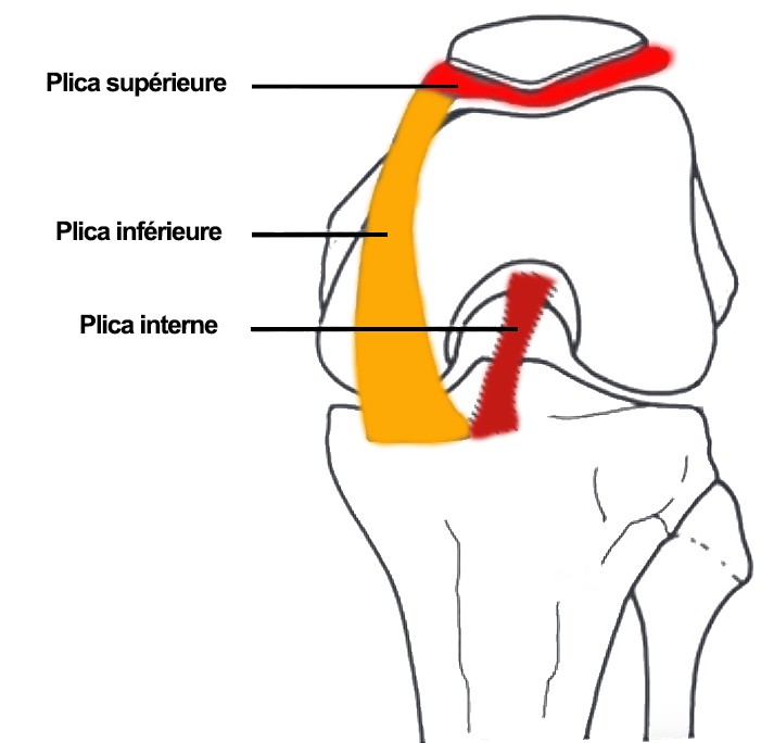 La plica : quand la douleur au genou reste inexpliquée